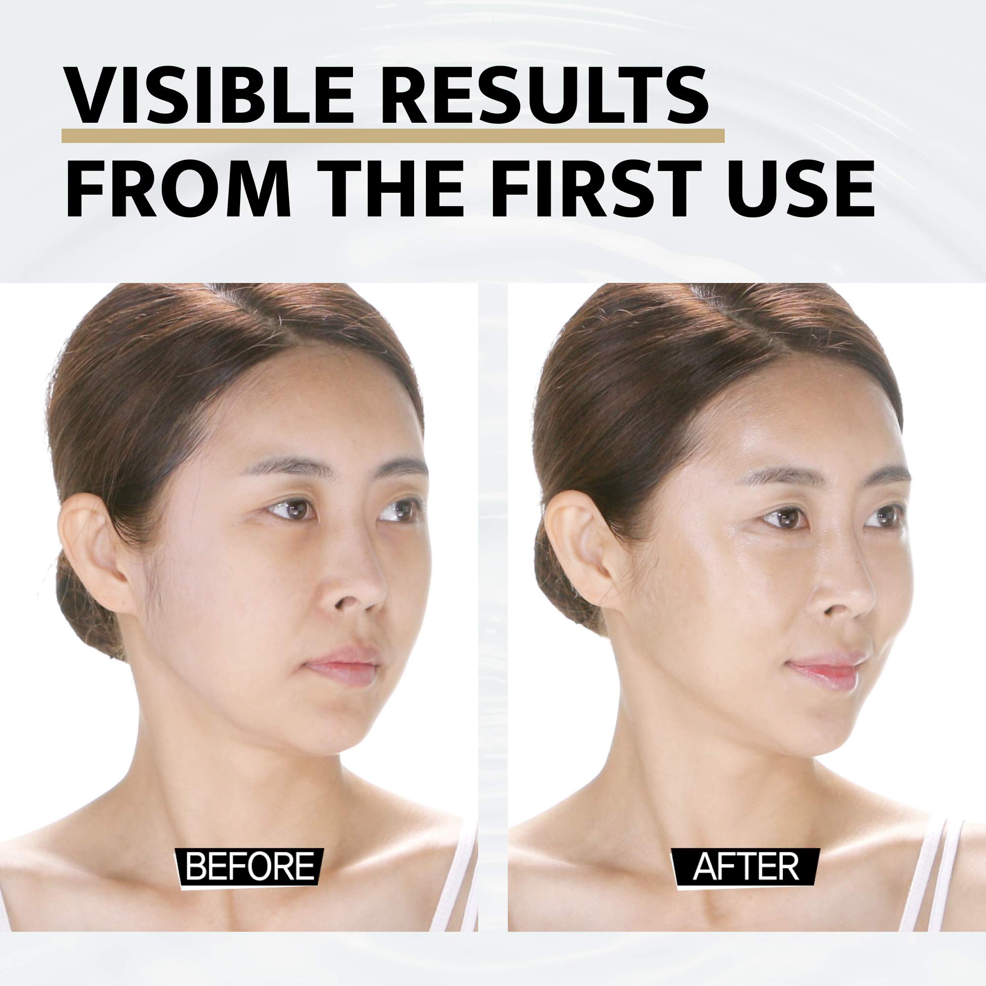 The Perfect Face lifting system with high Quality, Anti aging forever ...